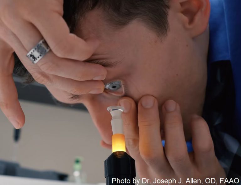 Scleral and Hybrid Lens Insertion- Augmented Vision Labs™