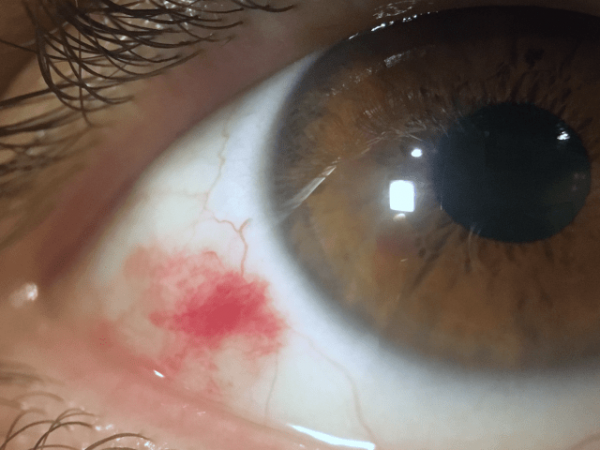 Home - Augmented Vision Labs™